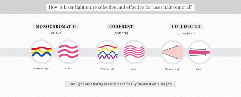 What is the difference between an IPL and laser? - | Urbana